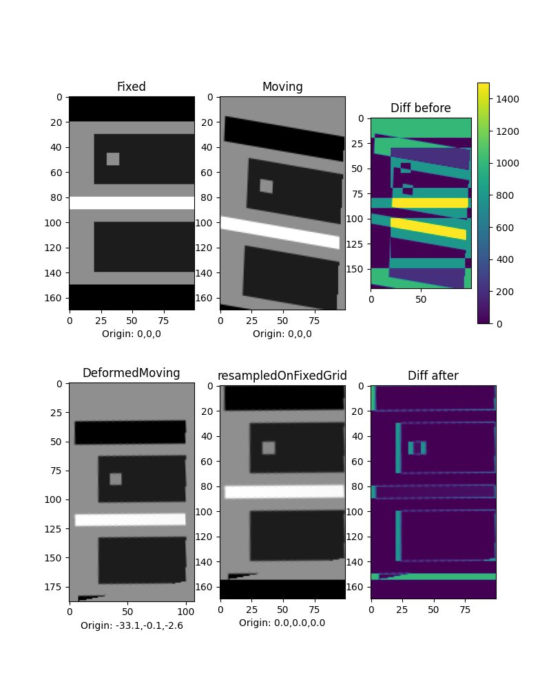 Rigid registration | OpenTPS